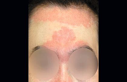 10 Reasons Your Face Is Red