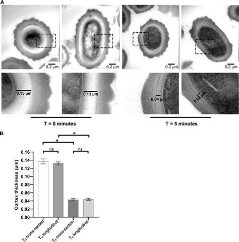 Imaging Clostridioides Difficile Spore Germination And Germination Proteins Journal Of