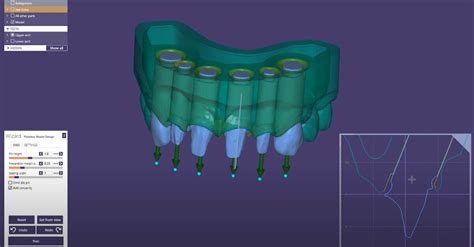Exocad Video Tutorial Model Creator