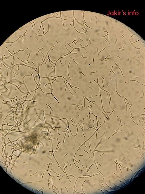 Jakir Hosen On Linkedin ☞ Bacillus Subtilis Under Microscope 40x Lense Someone May Think These…