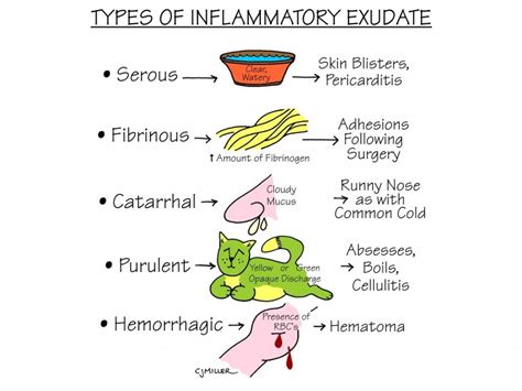 Nursing Study Types Of Inflammatory Exudate Studypk