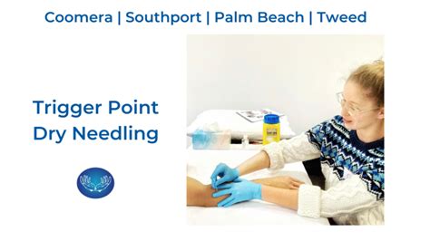 Trigger Point Dry Needling Active Hand Therapy