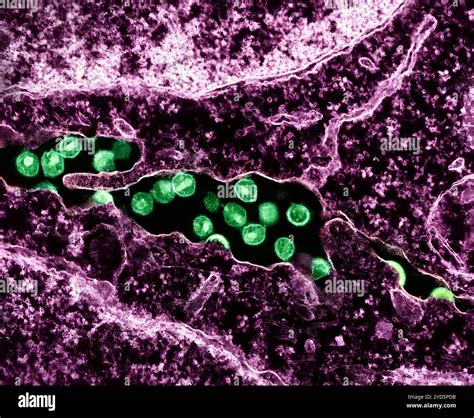 Colorized Transmission Electron Micrograph Of Hiv 1 Virus Particles Green Budding And