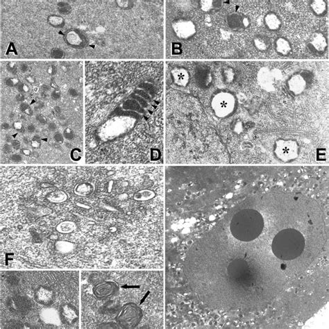A Normal Mitochondrial Morphology In A 1 Cell In Vivo Embryo B