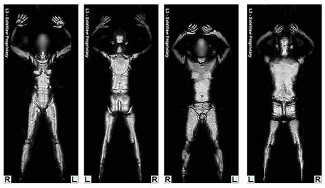 Full Body Scanner Wikipedia