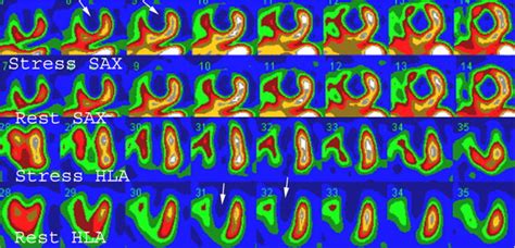 The Defect Reversibility Non Reversible Or “fixed” Defects Selected Download Scientific