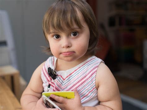Chromosomal Abnormalities Down Syndrome