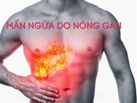 N I M N Ng A Do Gan Tri U Ch Ng V C Ch Ph Ng Ng A