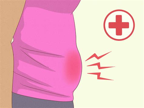 Ways To Cure Stomach Bloating WikiHow