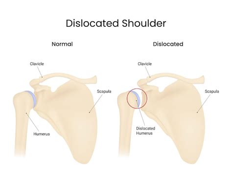 Shoulder Cut Vectors Download Free High Quality Vectors From Freepik