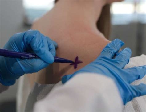 Trigger Point Injections In Rosemont Targeted Relief Rxwellness