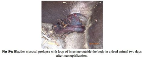 Tube Cystostomy Vs Bladder Marsupialization Clinical And