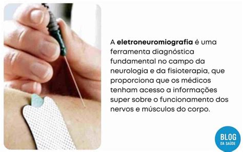 What Is Electromyography Enmg What Is It For
