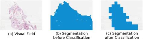 An Example Of The Results Of Tissue Segmentation On A Region Containing