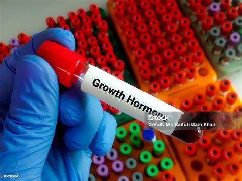 기술자의 푸른 장갑 손 성장 호르몬 테스트를 위한 혈액 샘플을 보유 호르몬에 대한 스톡 사진 및 기타 이미지 호르몬 성장 개념 혈액검사 Istock