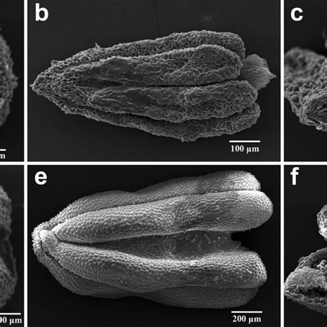 SEM Micrographs Of Sexual Organs In Tournefortia Argentea A B C Download Scientific Diagram
