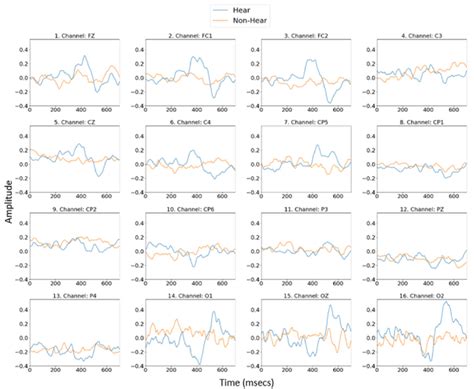 P300 Signal Effect On The Hearing Performance In Data From All Download Scientific Diagram