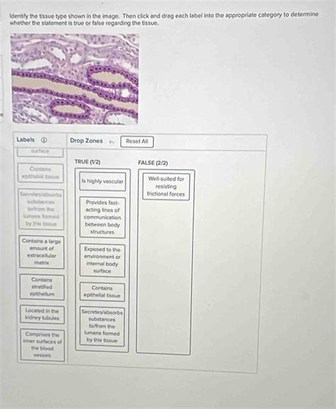 Solved Ldentify The Tissue Type Shown In The Image Then Click And