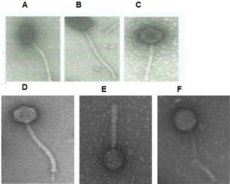 Transmission Electron Microscopic Tem Image Of Pseudomonas Aeruginosa Download Scientific