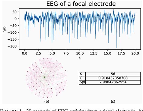 Figure 1 From Identification Of Focal Epileptic Regions From