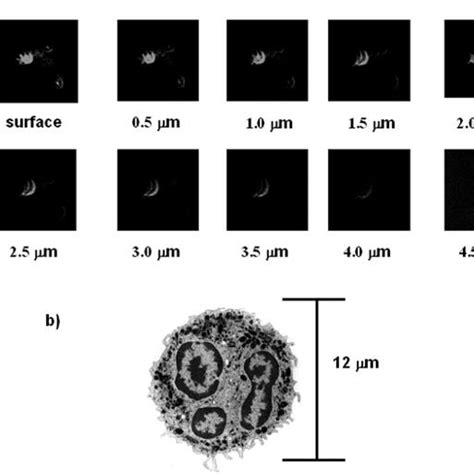 Localization Of Glutaminase At The Ruffled Cell Surface Of Human Download Scientific Diagram
