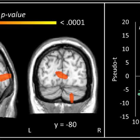 Sex Differences In The Correlation Between Theta Activity And Download Scientific Diagram