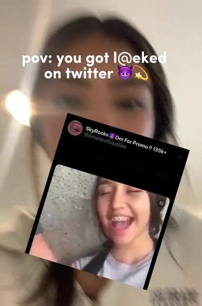 Who Is Braces Girl On Tiktok Leaked Video Viral