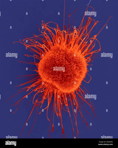Human Dendritic Cell Coloured Scanning Electron Micrograph Sem