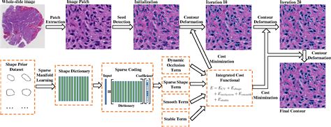 effective nuclei segmentation with sparse shape prior and dynamic occlusion constraint for