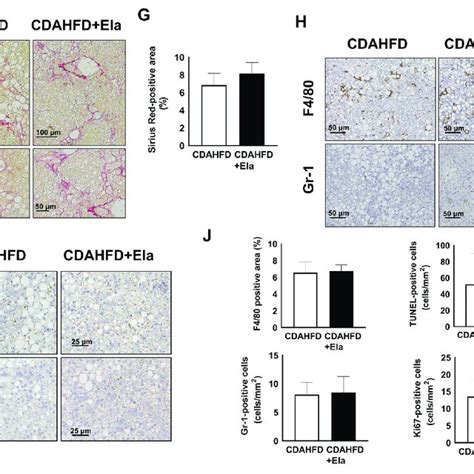 Nafld Activity Score In Chimeric Mouse Livers Fed A Cdahfd 14 W With