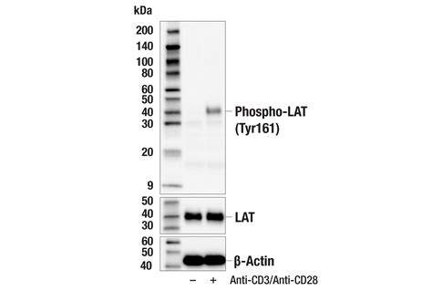 Phospho Lat Tyr161 E9q2r Rabbit Mab Cell Signaling Technology