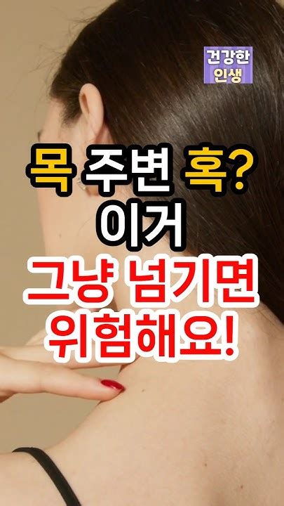 목 주변 혹 이거 그냥 넘기면 위험해요 목주변 이것 보이면 당장 병원가세요 Youtube