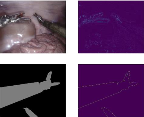 Figure 5 From Towards Unsupervised Learning For Instrument Segmentation In Robotic Surgery With