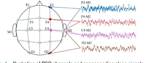 Figure 1 From A Spatial Temporal Transformer Architecture Using Multi