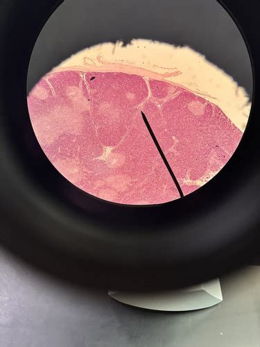 Id Under A Microscope Lymphatic System Flashcards Quizlet