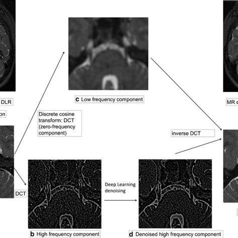 Schema Of The Denoising Process With Deep Learning Based Reconstruction Download Scientific