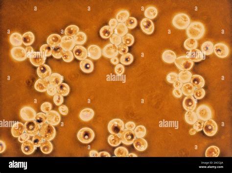 Yeast Cells Light Micrograph Yeasts Are Single Cell Fungi Some Yeasts Have Industrial Uses
