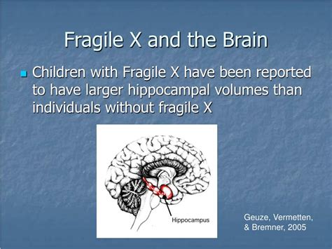 PPT Fragile X Syndrome PowerPoint Presentation Free Download ID 4319720