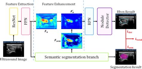 The Overall Framework Of Fdnet Primarily Including Feature Extraction