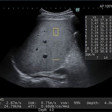 The Attenuation Measurement Function Technique Was Developed By Download Scientific Diagram