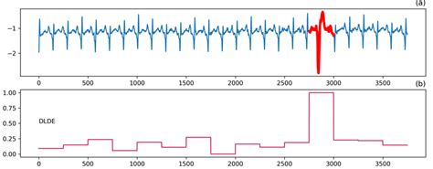 The Results On Ecg Data Chfdb01 275 And Chfdb13 45590 Download Scientific Diagram