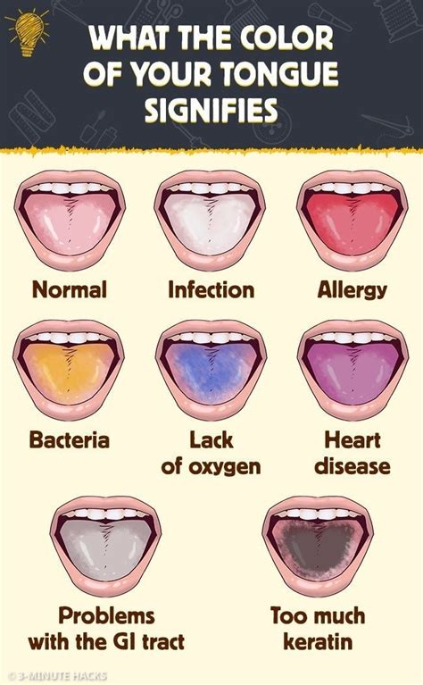 What The Color Of Your Tongue Signifies Tongue Health Tongue Health