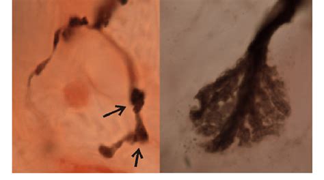 separation of itd and ild information the synapses of the collaterals