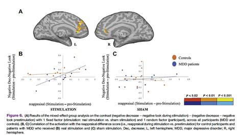 Transcranial Direct Current Stimulation Over The Prefrontal Cortex In Depression Modulates Cortical