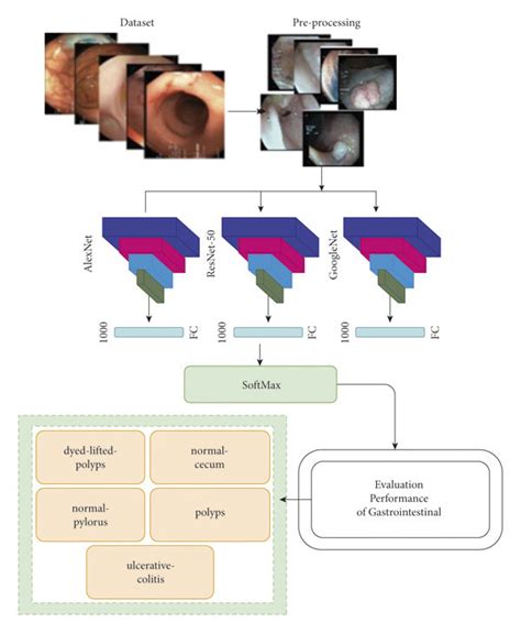 A General Structure Of Gastrointestinal Disease Detection By Deep Learning Download
