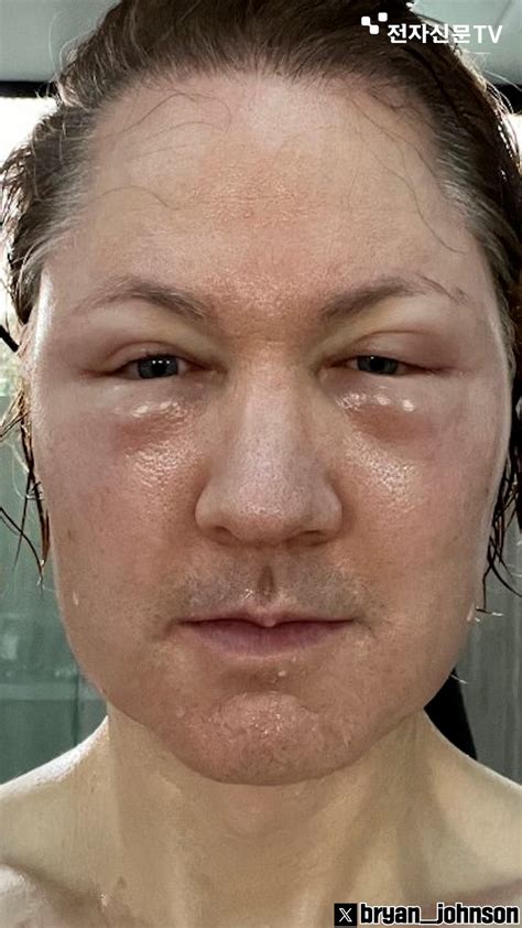 회춘을 위해 지방이식한 억만장자의 최후 회춘 피부 시술 오늘의 숏 Beta