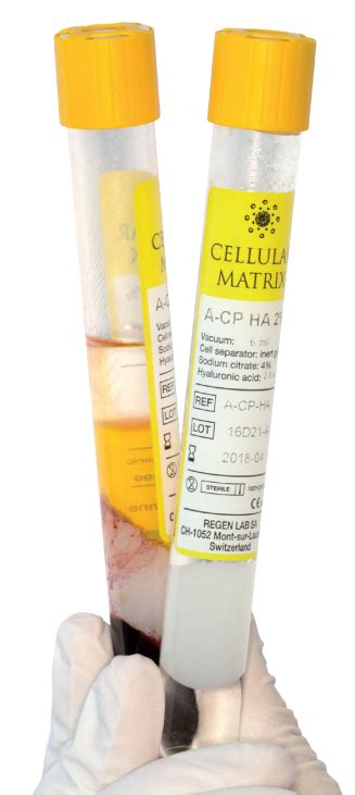 Regenlab Prp Rejuvenate Face Clinic