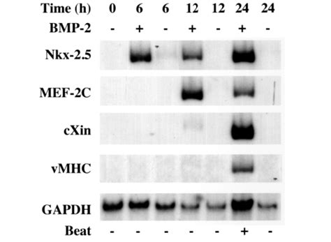 Induction Of Cardiac Gene Expression By Bmp2 Cultures Of Chick
