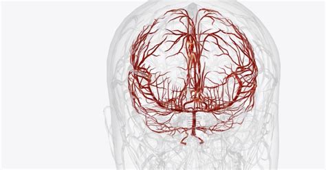 Cavernoma Signs Causes Treatment