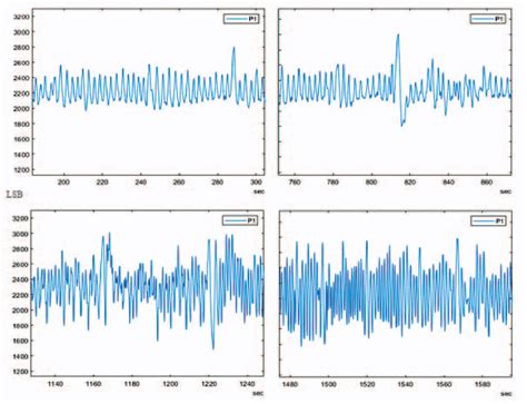 Figure 8 From The Use Of An Inductive Sensor In The Assessment Of